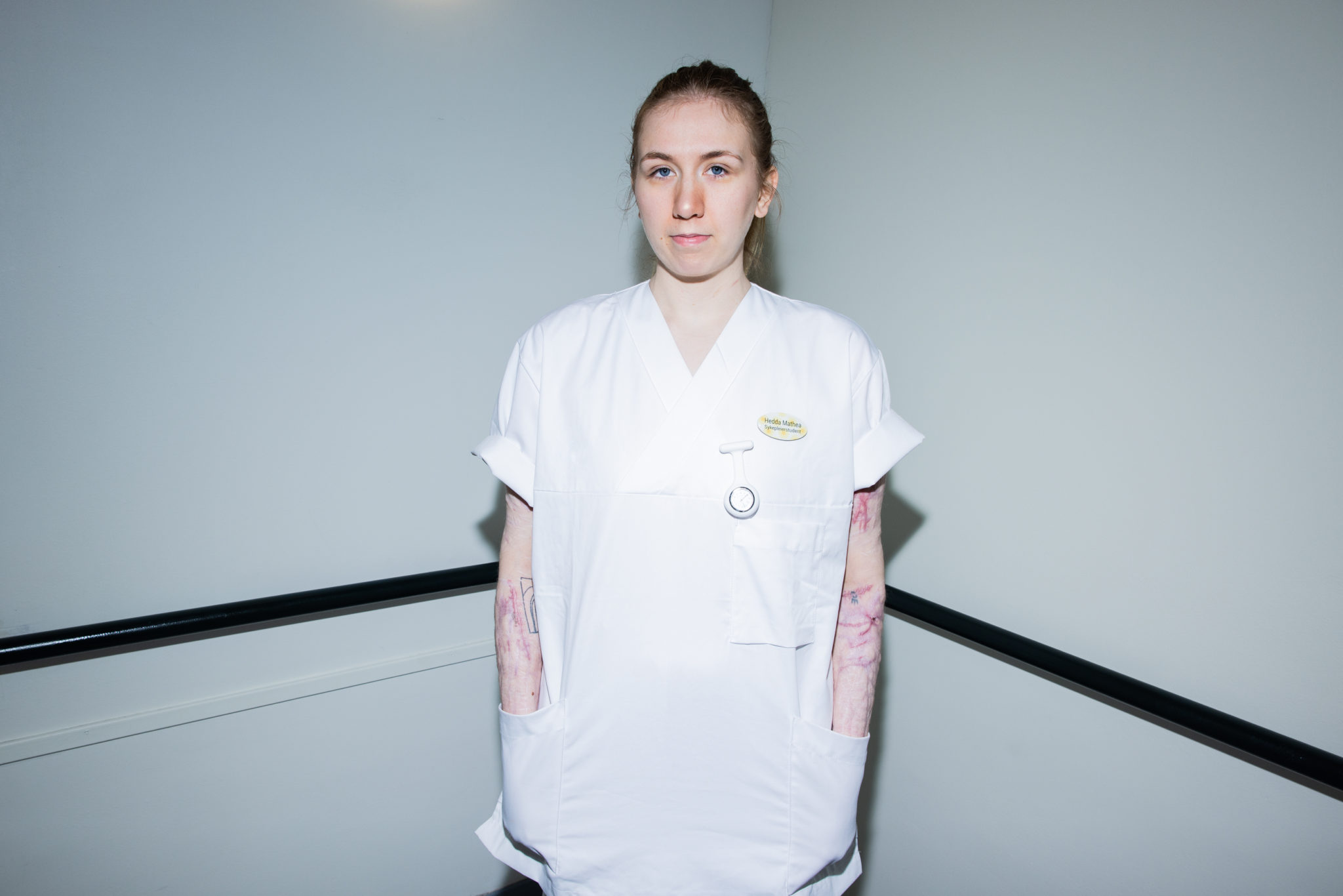 p3.no » Tiden etter selvskading