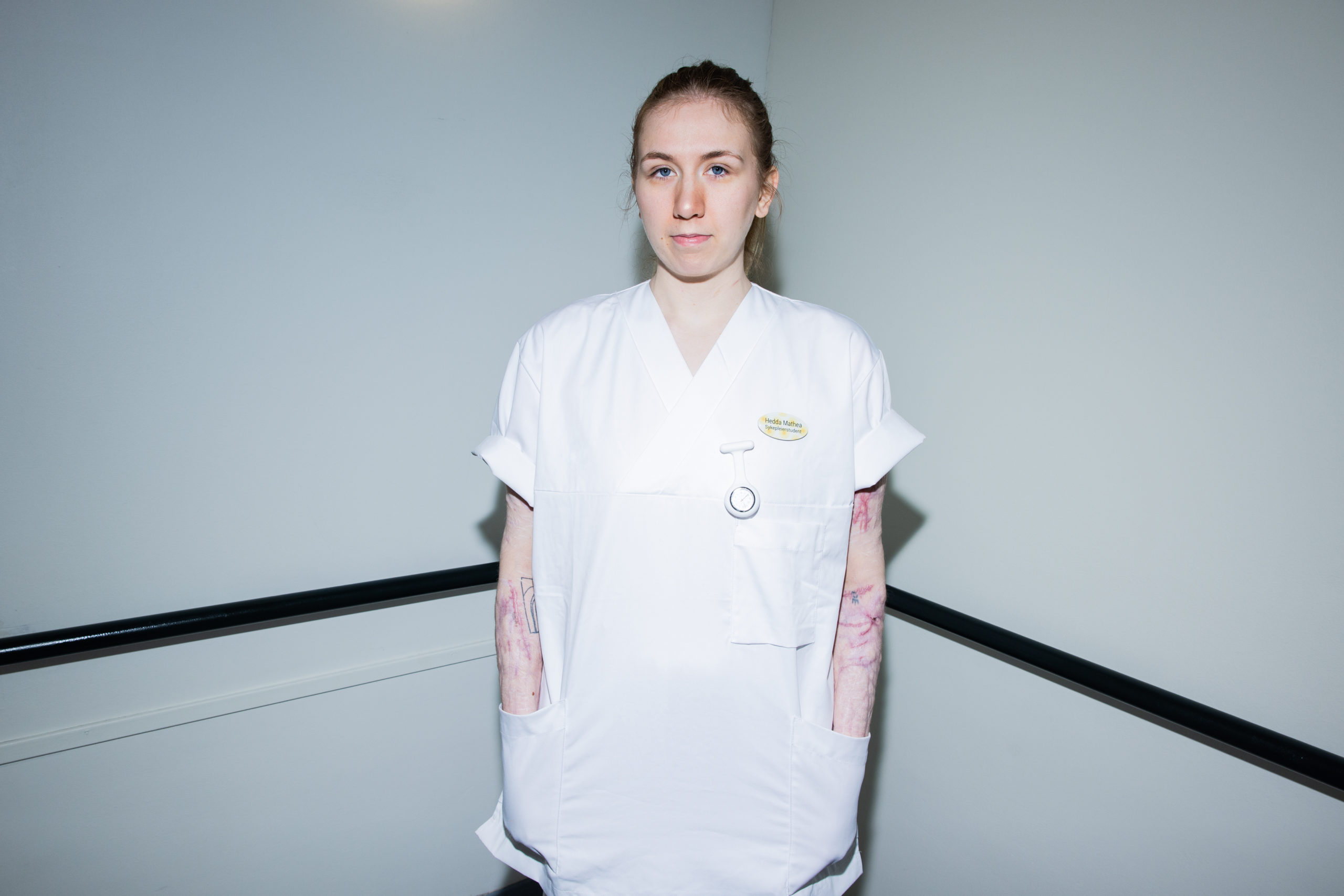 p3.no » Tiden etter selvskading